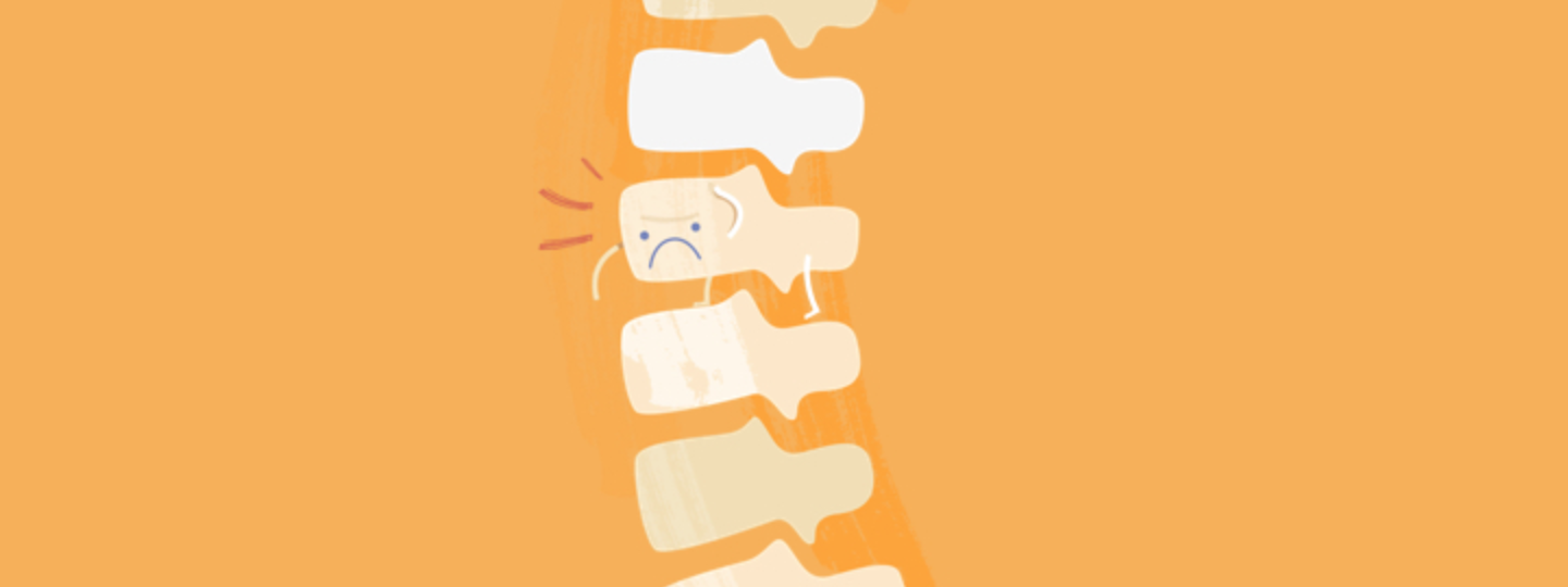 Exploring the Diverse Types of Spondyloarthritis